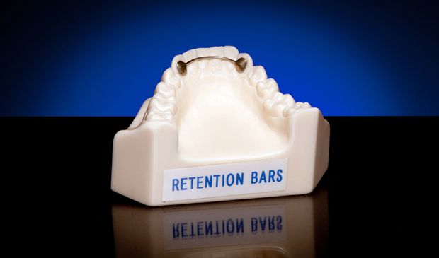 Bonded Lingual Retainer - Royal Orthodontic Laboratories