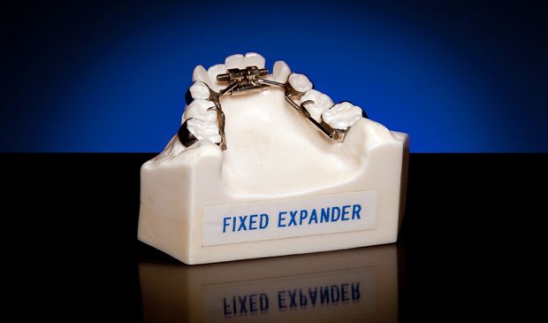 Fixed Lower Expansion Appliance - Royal Orthodontic Laboratories